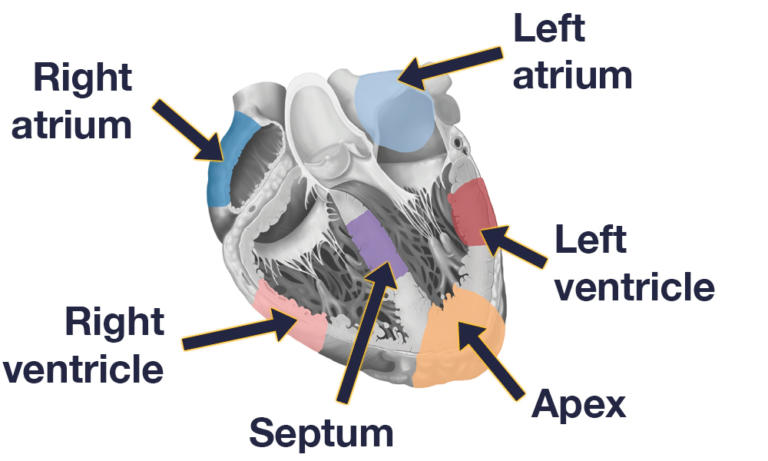 Highly detailed map of human heart could guide personalised heart ...