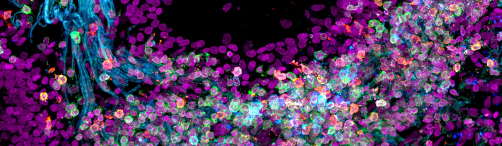 Single-cell atlas of the whole human lung