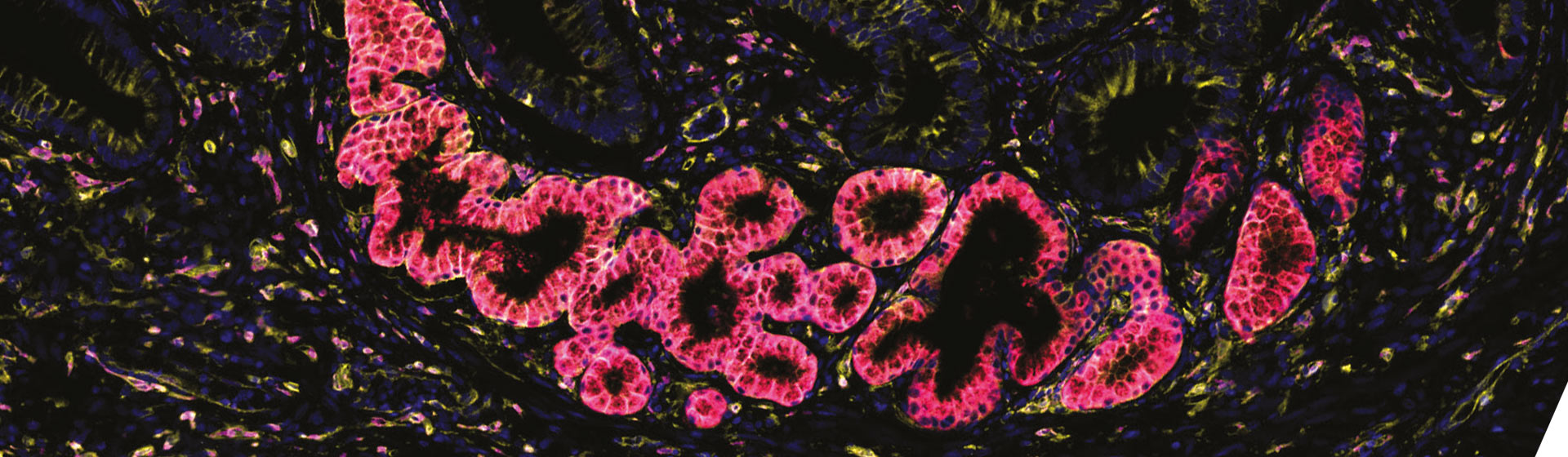 Wellcome Sanger Institute - Genomics Research Institute in Cambridge