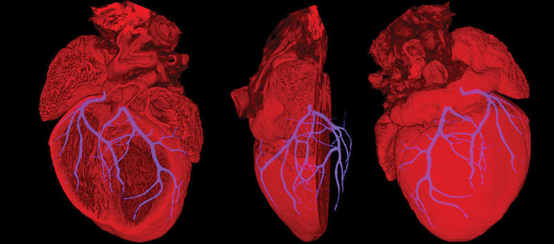 Cambridge heart research boosted by £6 million British Heart Foundation ...
