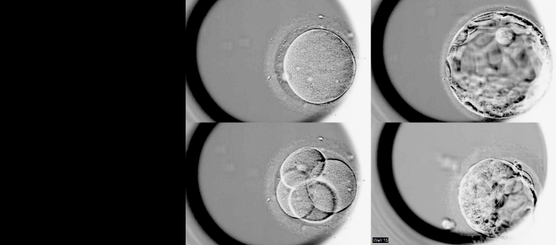 Genome editing reveals role of gene important for human embryo development