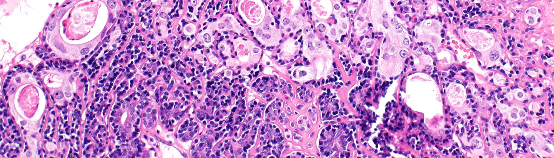 New DERMATLAS project will create world’s most comprehensive public ...