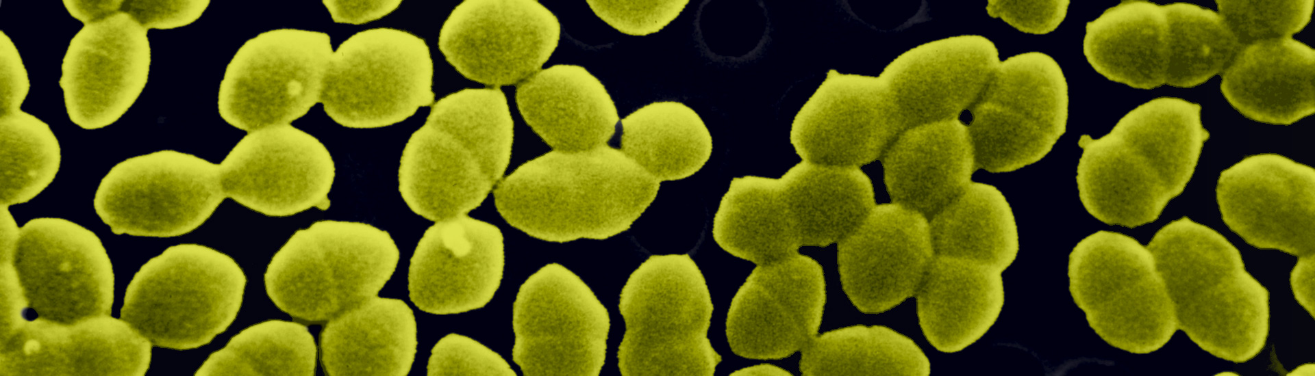 Full evolutionary journey of hospital superbug mapped for the first time