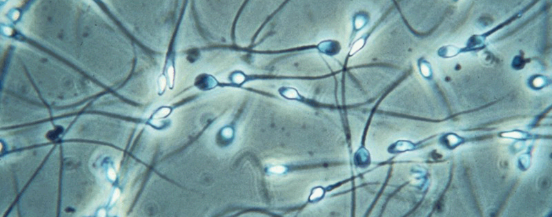 Sperm mutation rate varies between fathers